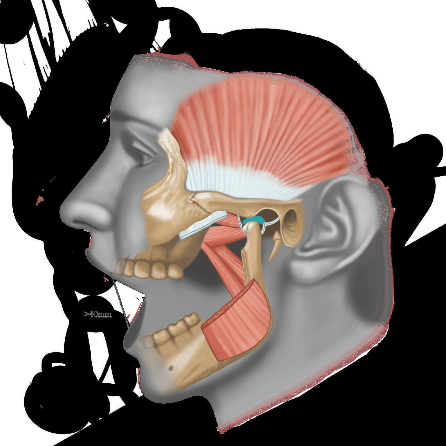 المفصل الفكي الصدغي - أهم 5 أسباب اضطراب المفصل الفكي الصدغي